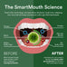SmartMouth™ Original Activated Mouthwash (16oz)